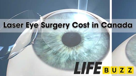 Laser Eye Surgery Cost In Canada: Does Insurance Cover?